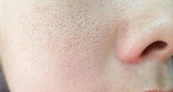 7 Cara Mengecilkan Pori Pori Wajah